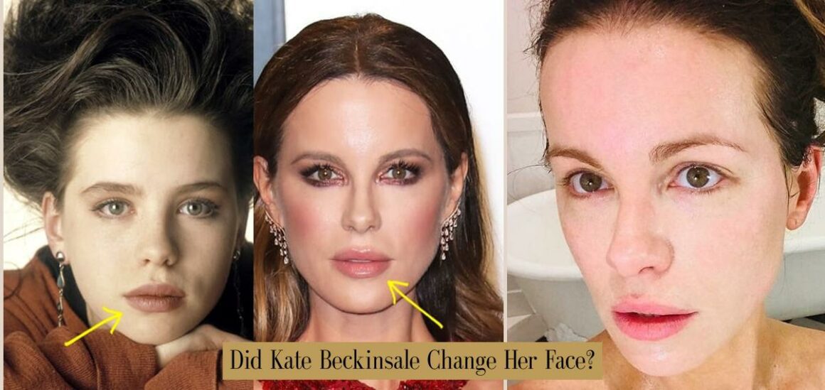 Did Kate Beckinsale Change Her Face? - Atlas Singularity — Money ...