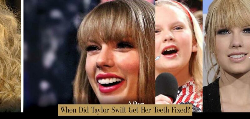 When Did Taylor Swift Get Her Teeth Fixed? - Atlas Singularity — Money ...
